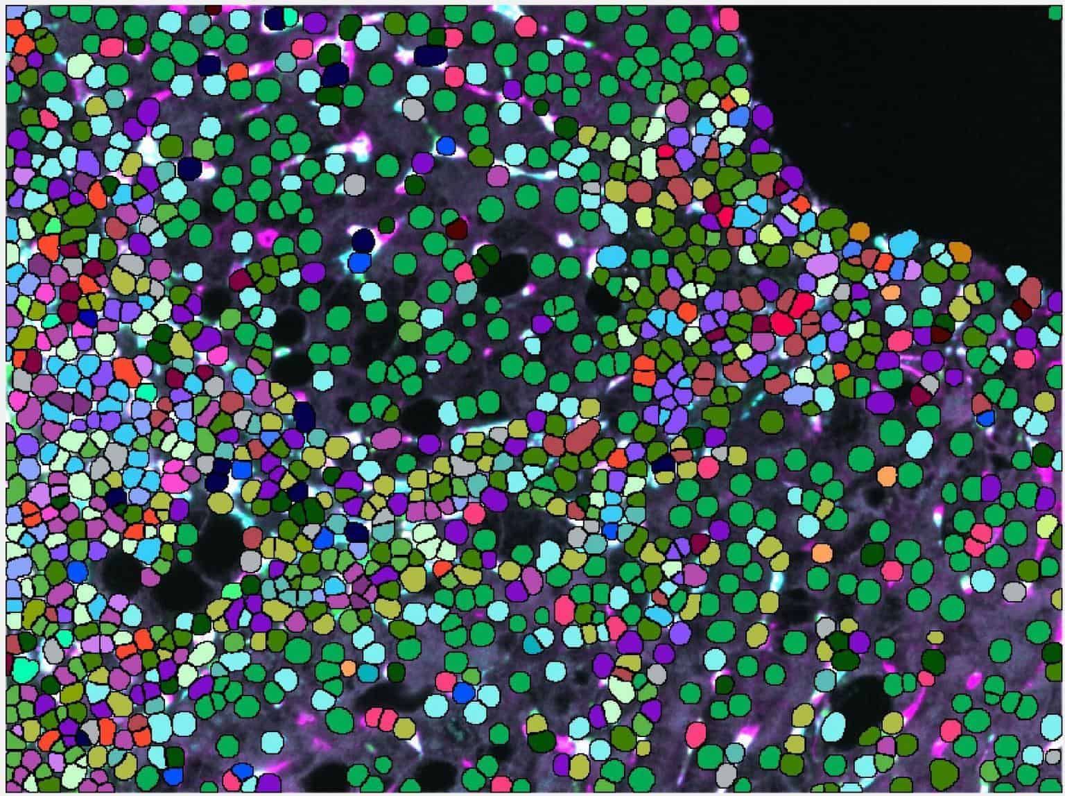 Deep learning improves the accuracy of multispectral image analysis for ...
