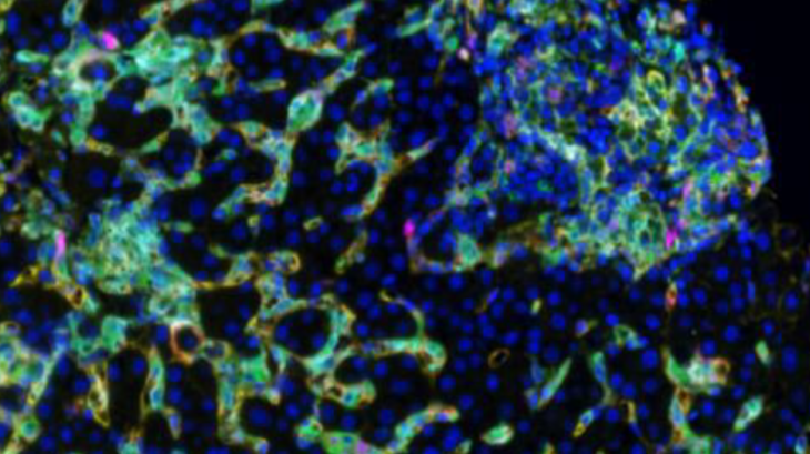 Deep learning improves the accuracy of multispectral image analysis for ...