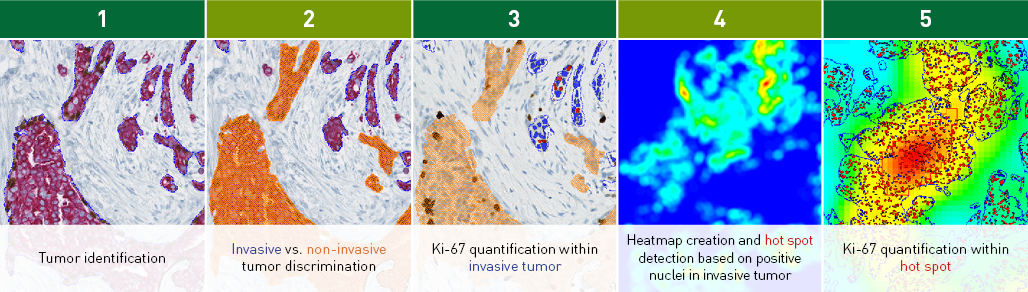 Hot Spot - Visiopharm · Pathology image analysis software
