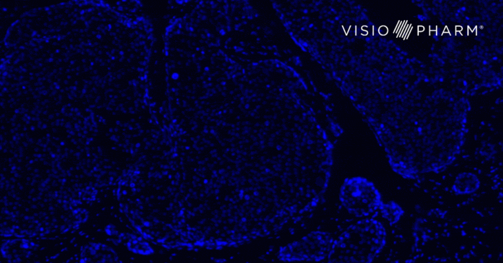 Visiopharm Research Solutions - Propelling pathology forward