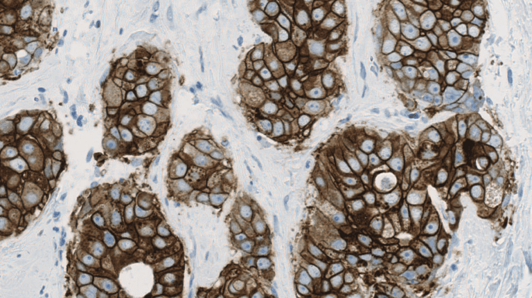 Visiopharm granted patents for stain quality management in tissue ...