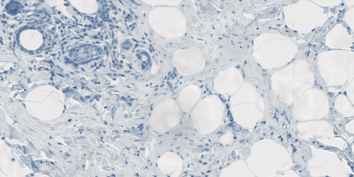 Visiopharm's AI-powered image analysis software selected to analyze the ...