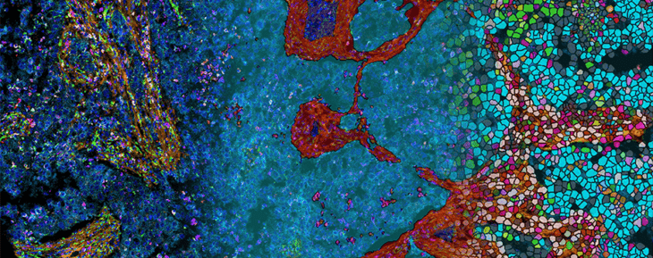 Standard BioTools and Visiopharm announce partnership for the ...