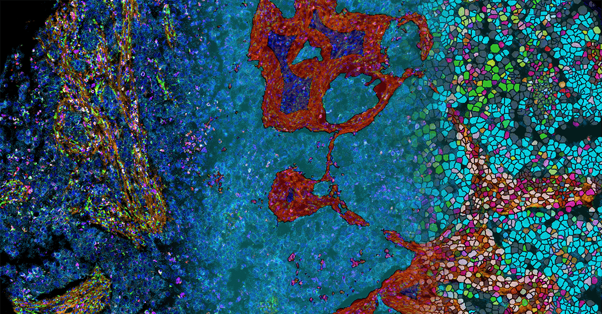 Standard BioTools and Visiopharm announce partnership for the ...