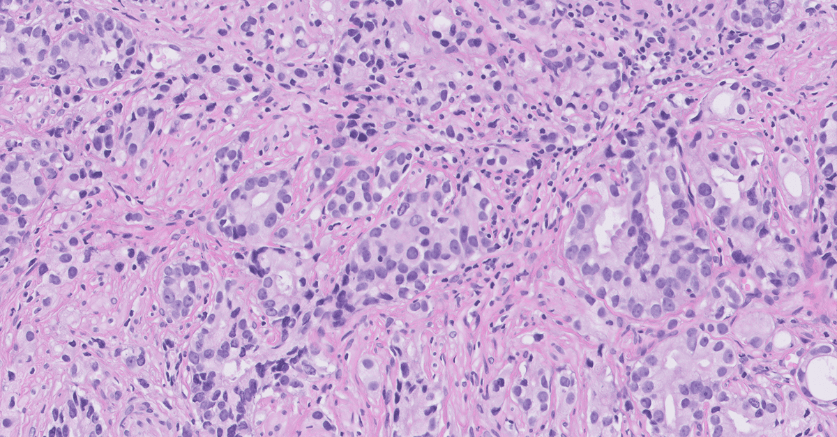 Deep Bio and Visiopharm announce a collaborative integration of a ...