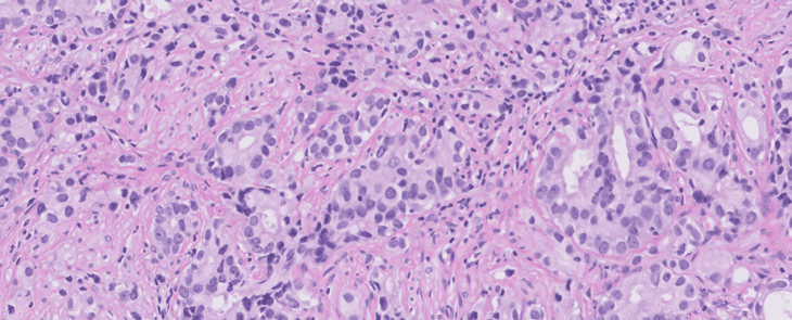 Deep Bio and Visiopharm announce a collaborative integration of a ...