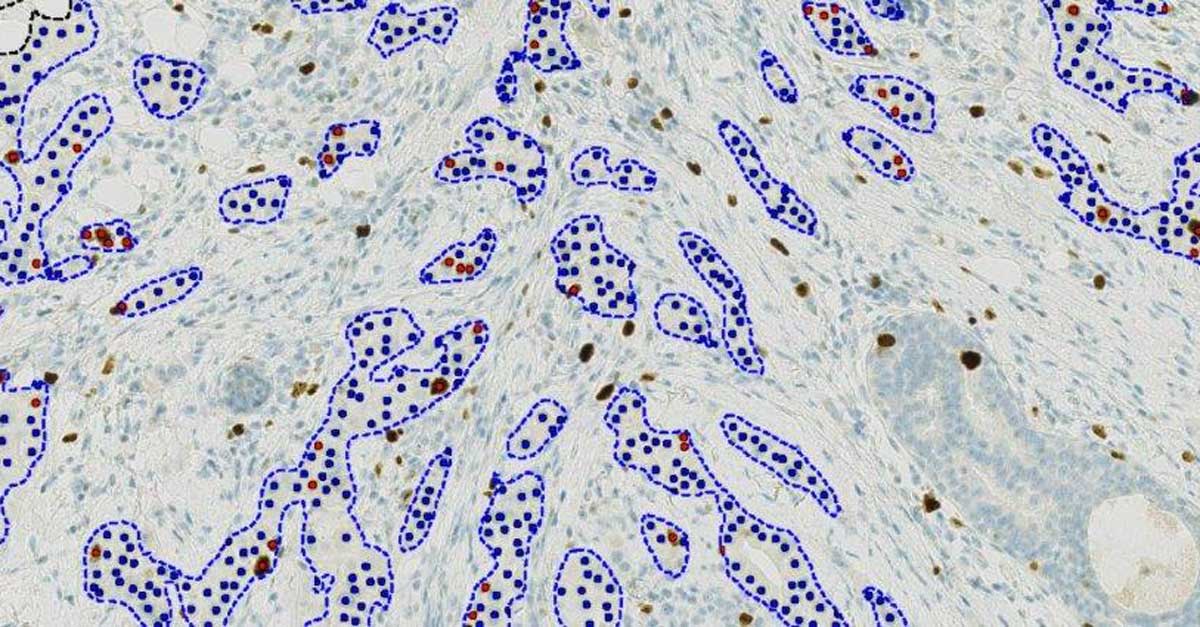 Visiopharm launches IVDR-cleared and fully automated next-generation ...