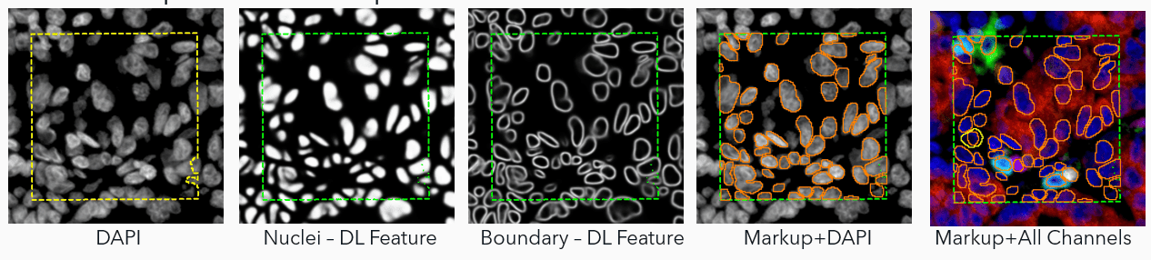 A Guide to Cell Segmentation in Multiplex Tissue Imaging with AI ...