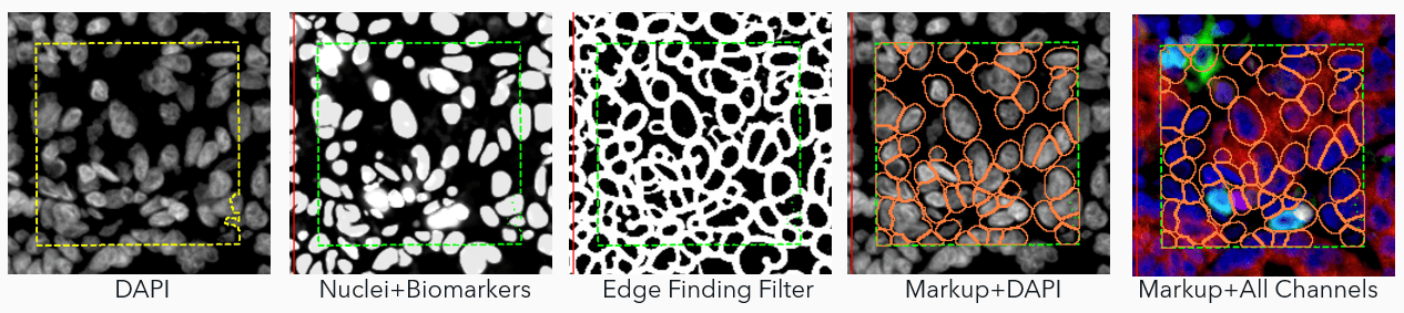 A Guide To Cell Segmentation In Multiplex Tissue Imaging With Ai