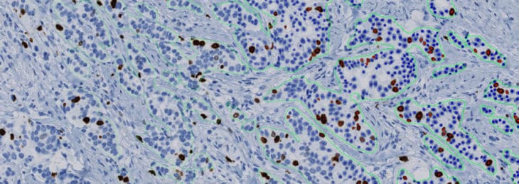 Minerva Imaging and Visiopharm announce collaboration on AI-based image ...