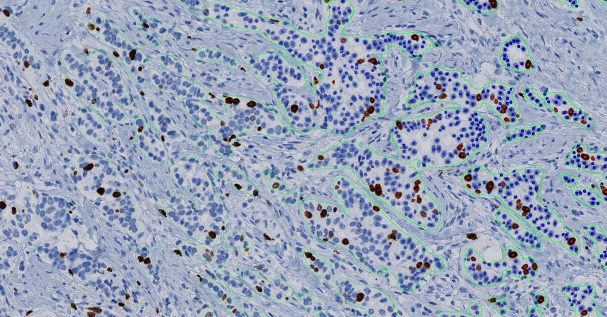 Minerva Imaging and Visiopharm announce collaboration on AI-based image ...