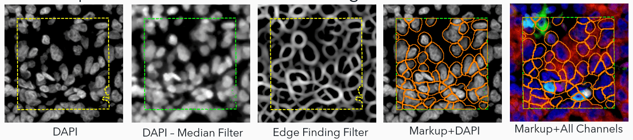 A Guide to Cell Segmentation in Multiplex Tissue Imaging with AI ...