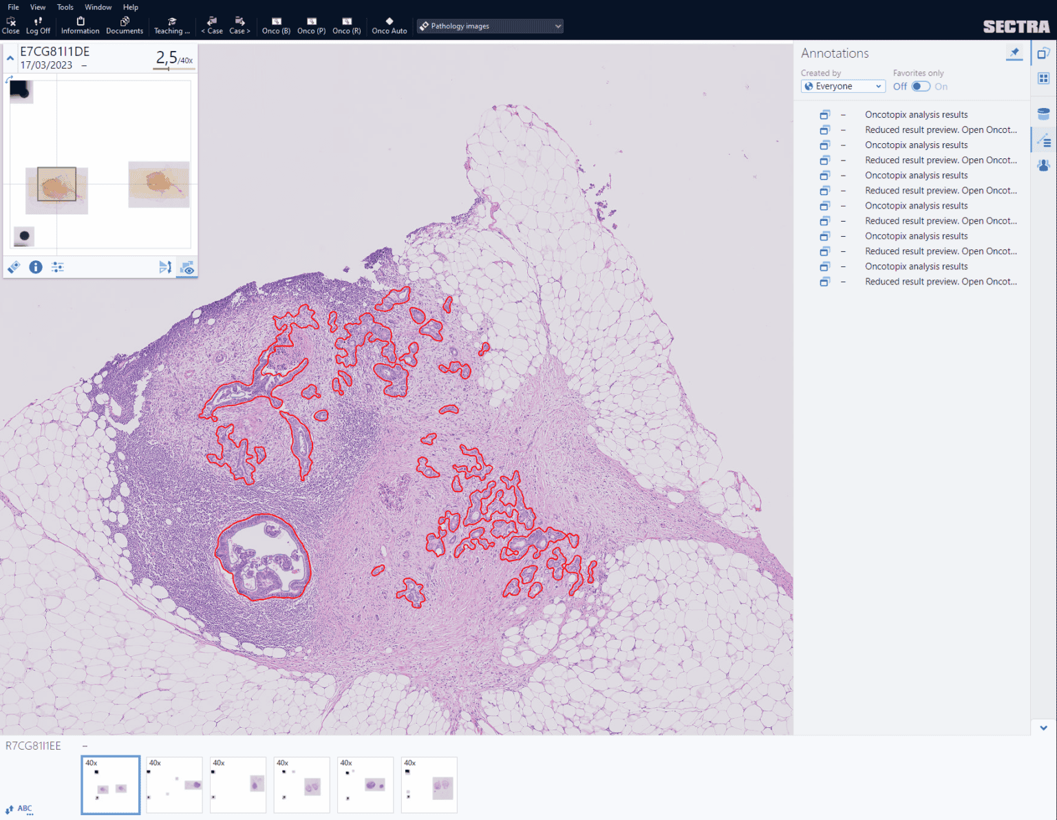 PACS-IMS Integrations - Visiopharm · Pathology image analysis software