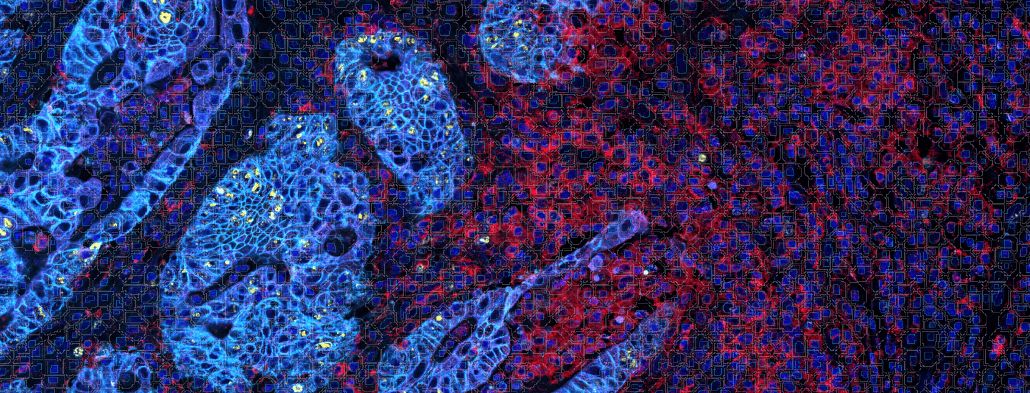 A Guide to Cell Segmentation in Multiplex Tissue Imaging with AI ...