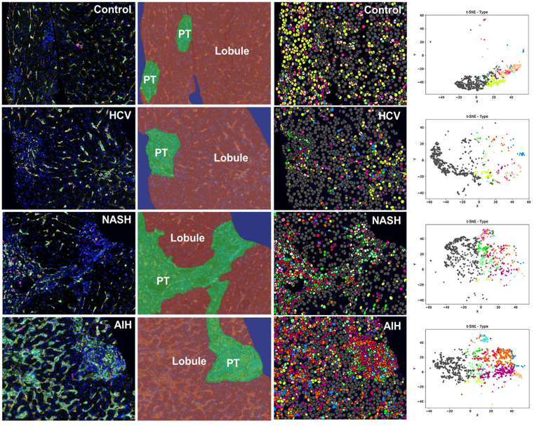 Decoding the Liver Microenvironment: A Conversation with Prof. Heather ...