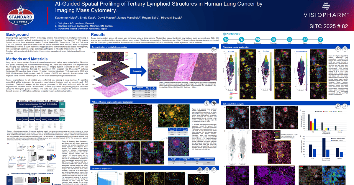 AI-Guided Spatial Profiling of Tertiary Lymphoid Structures in Human ...