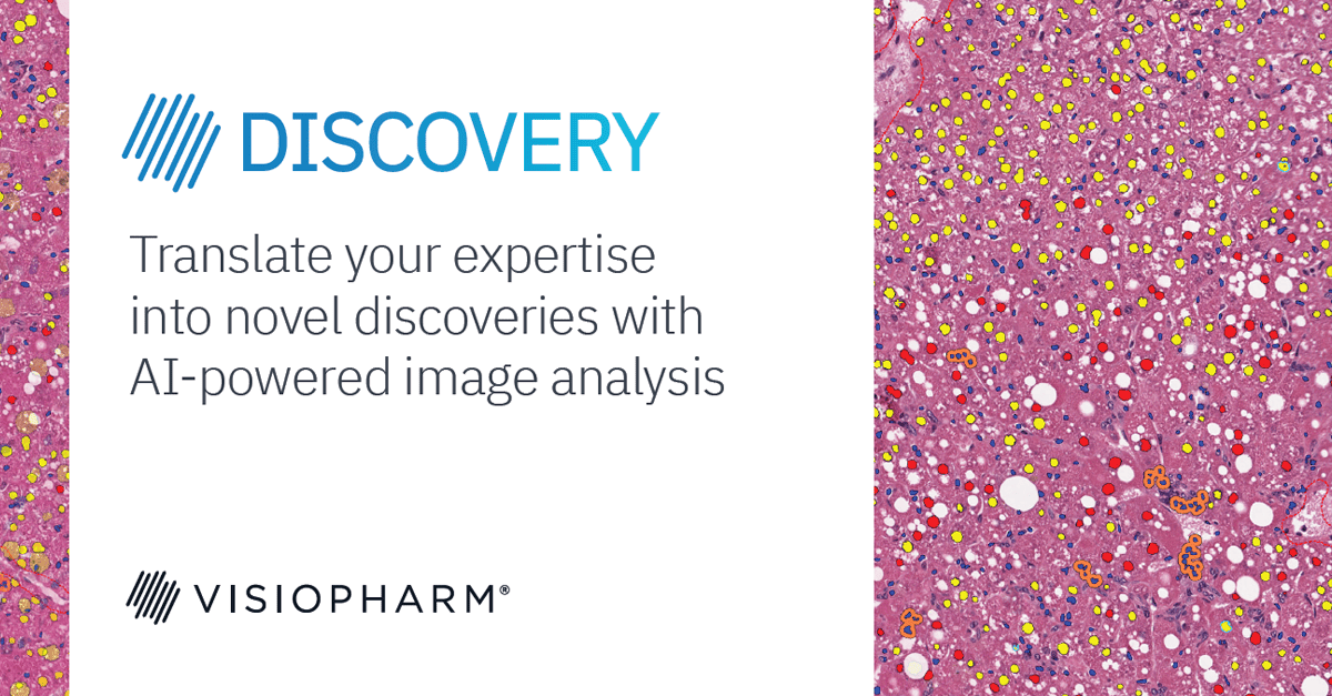 Discovery brochure - Visiopharm · Pathology image analysis software