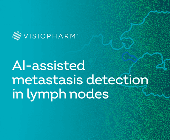 AI-assisted metastasis detection in lymph nodes - Visiopharm ... AI-assisted metastasis detection in lymph nodes - Visiopharm ...