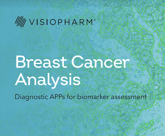 Oncotopix® Clinical Archives - Page 2 of 3 - Visiopharm · Pathology ...
