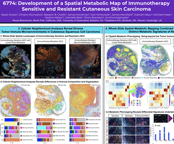 Development of a Spatial Metabolic Map of Immunotherapy Sensitive and ... Development of a Spatial Metabolic Map of Immunotherapy Sensitive and ...