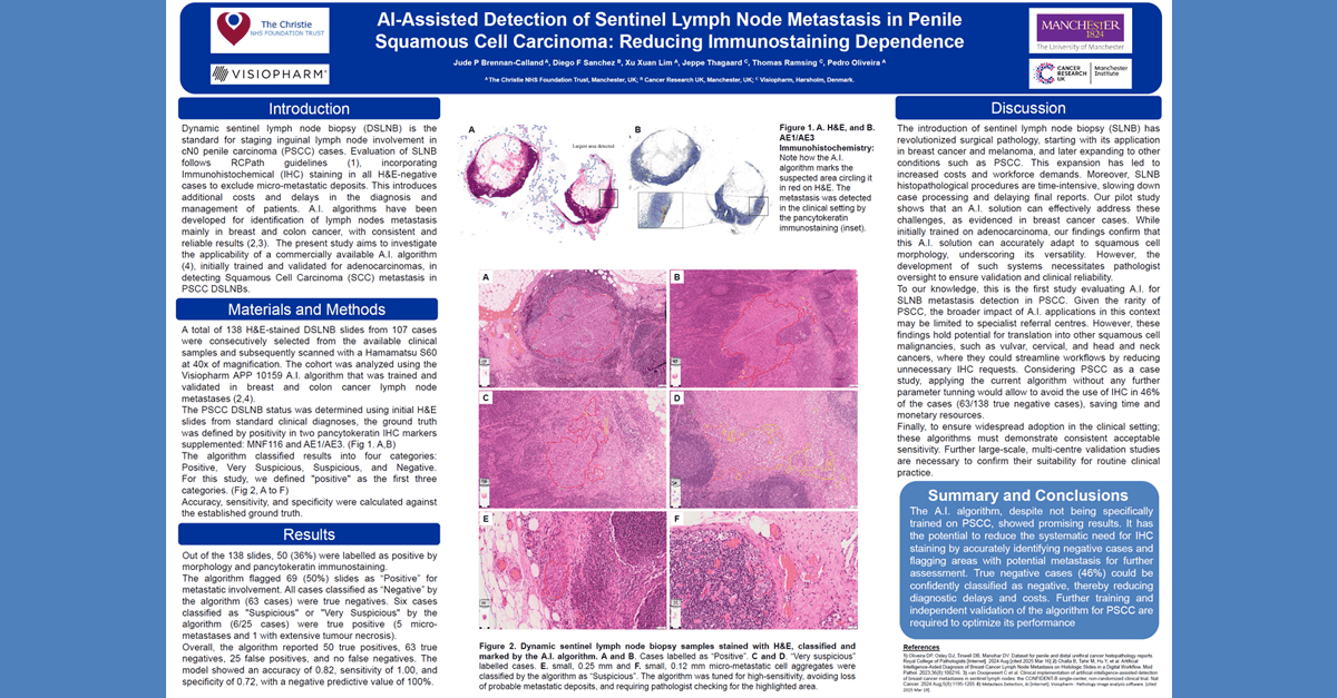 AI-Assisted Detection of Sentinel Lymph Node Metastasis in Penile ...
