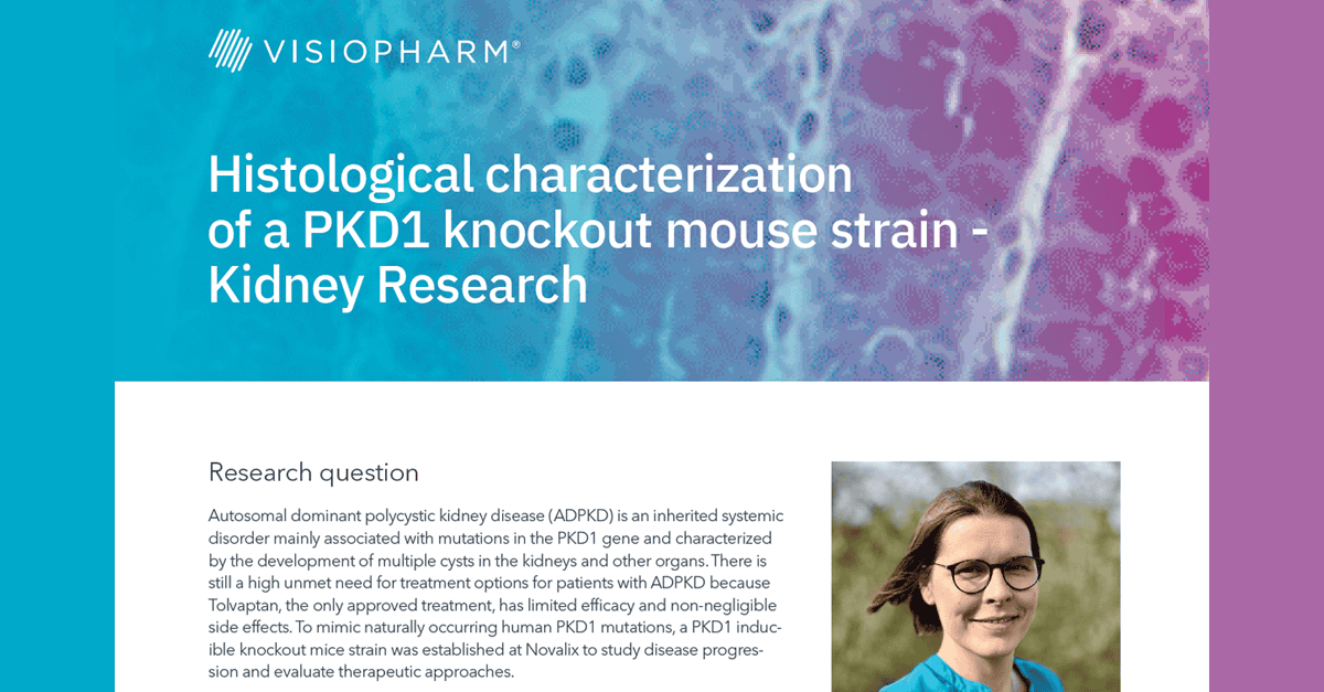 Histological characterizationof a PKD1 knockout mouse strain - Kidney ...